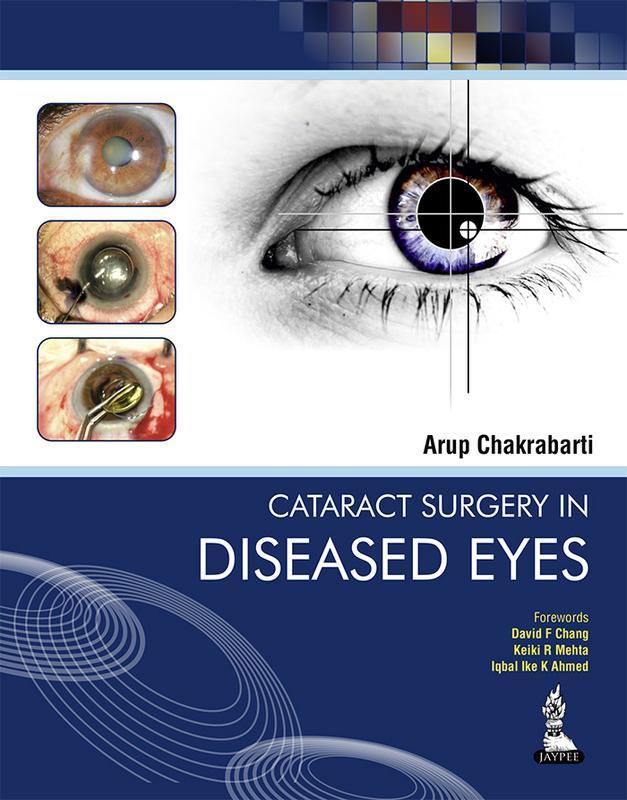 Buy Cataract Surgery in Diseased Eyes Book Online at Best Price | Bookscape