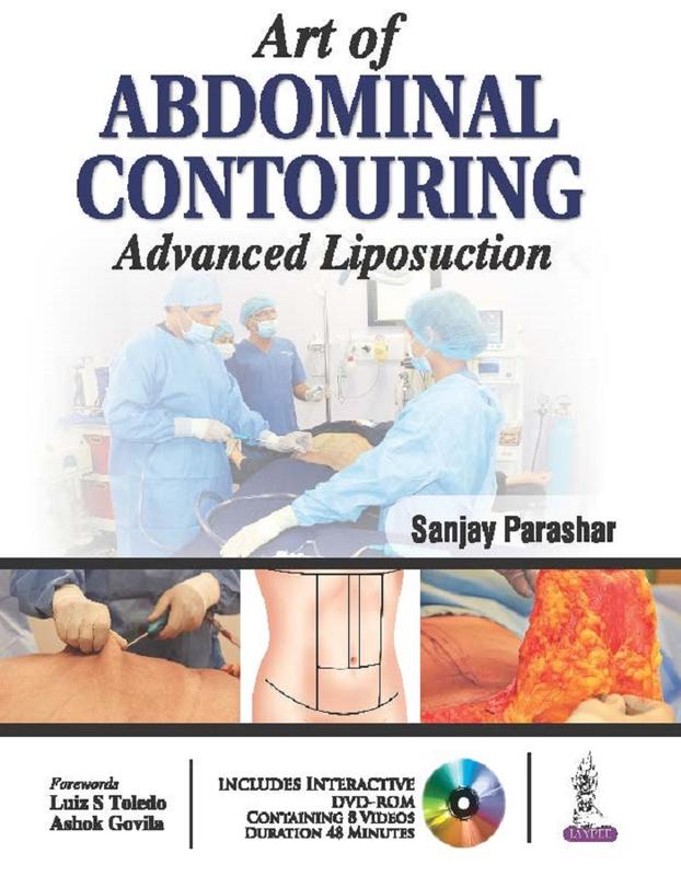 Bookscape | Buy Art of Abdominal Contouring: Advanced Liposuction
