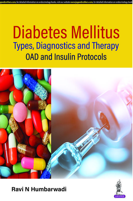 Buy Diabetes Mellitus- Types Diagnostics and Therapy: OAD and Insulin ...